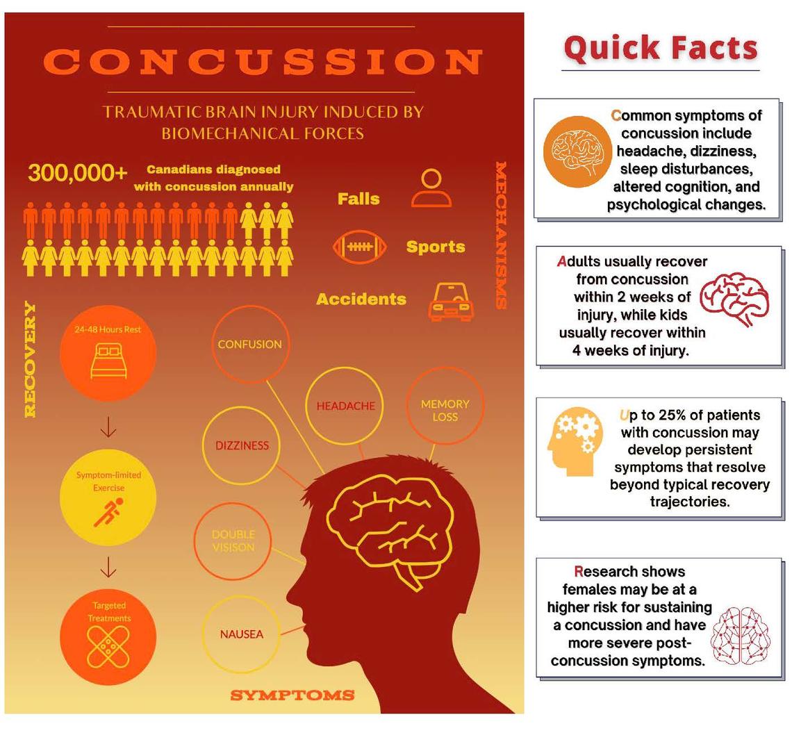 Concussion Education | Brain Neurorehabilitation Lab | Cumming School of Medicine | University ...